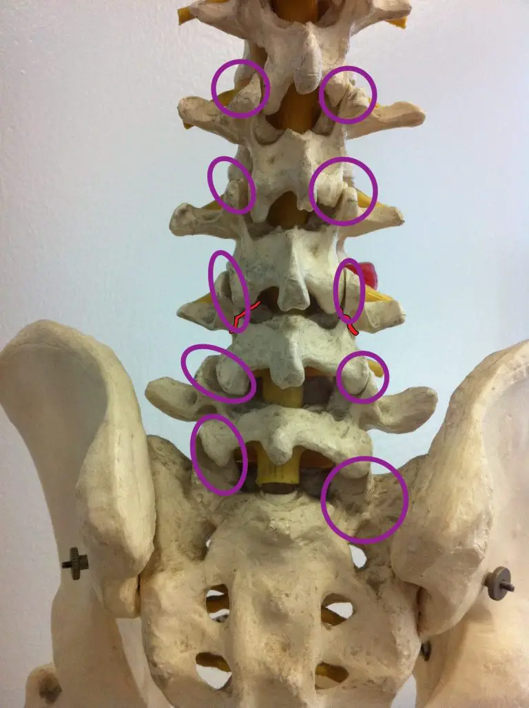 Artrosis lumbar: ¿Cómo aliviarla? (5 tratamientos)