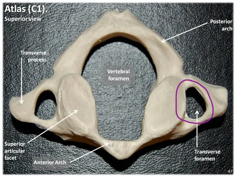 Apophyse transverse : Définition et anatomie (pathologies)