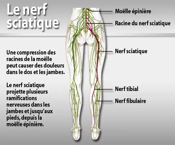 Douleur derrière le genou et sciatique : Quel lien ? (Causes) | Lombafit Douleur derrière le genou et sciatique : Quel lien ? (Causes) | Lombafit