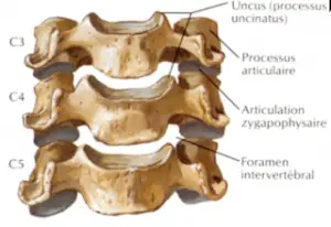 Uncodiscarthrose : Peut-on la guérir ? (traitement naturel)